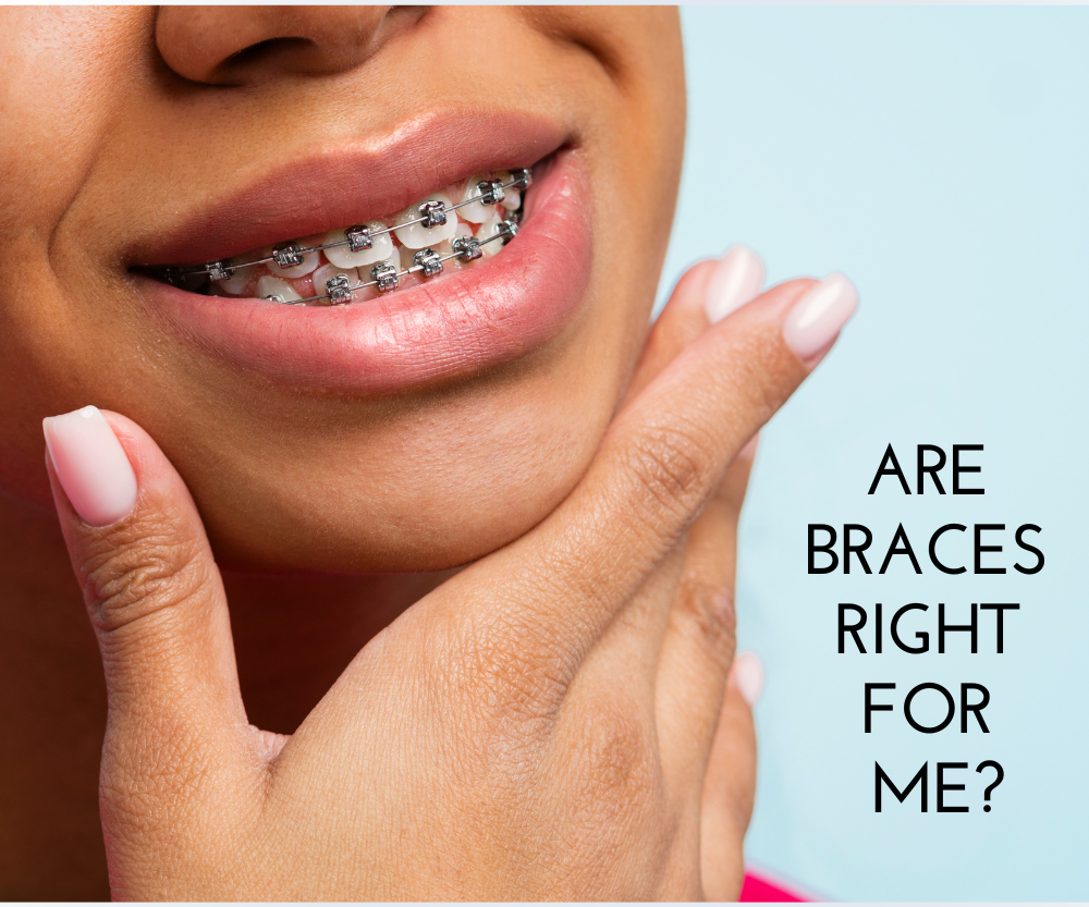 Are Braces Right for Me? | Wees & Low Orthodontics